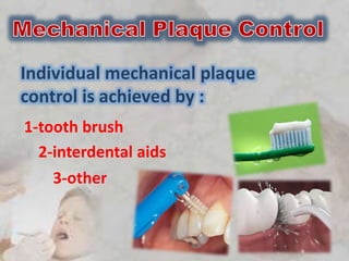 Preventive Dentistry (plaque control) | PPTX