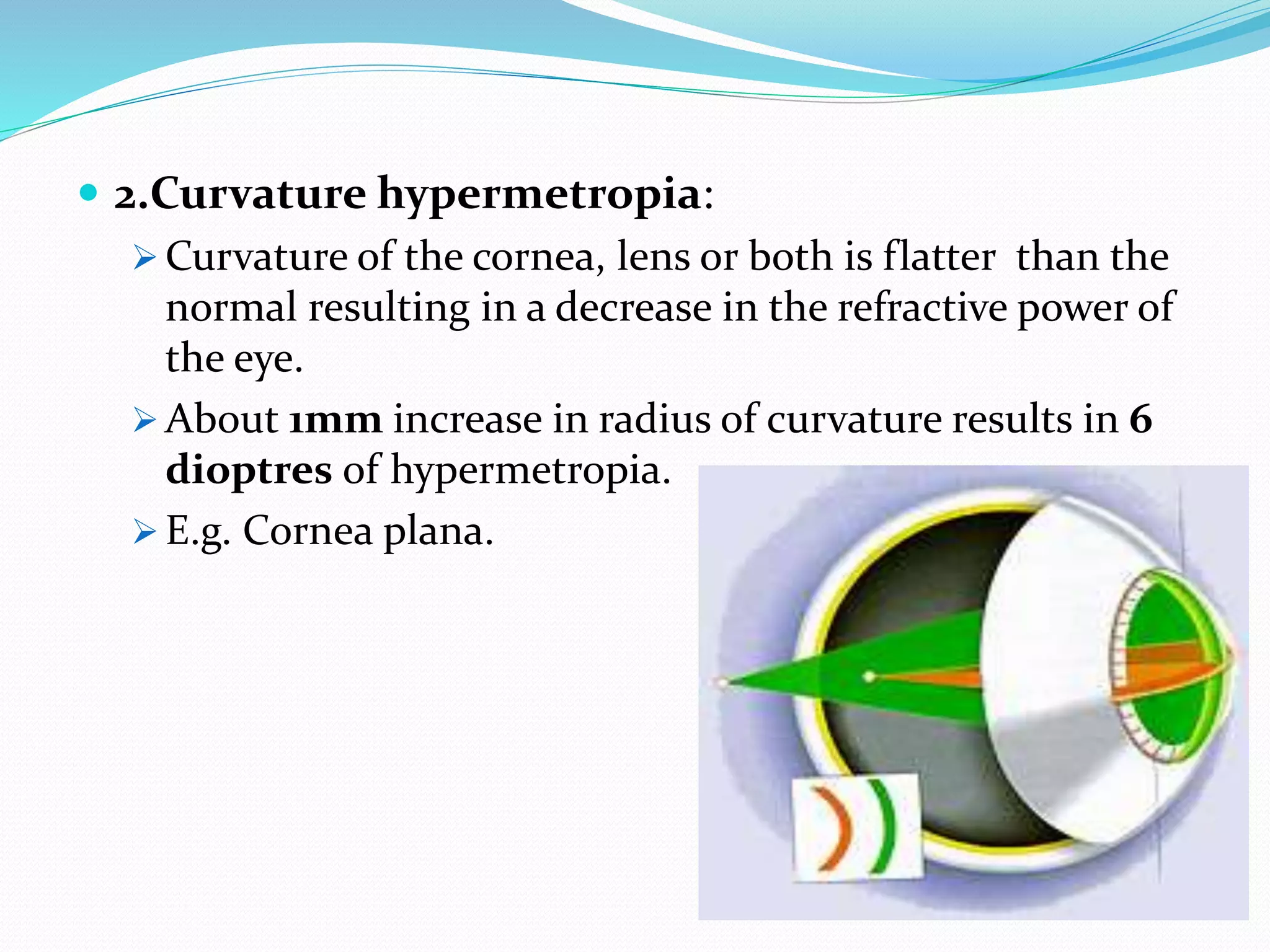 Hypermetropia also known as Hyperopia or Farsightedness is a common ...