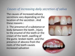 Salivary gland | PPT