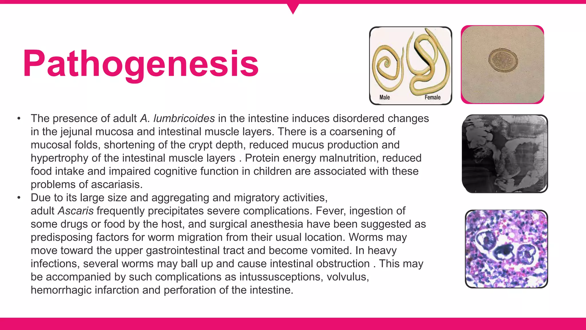 Ascariasis PPT | PPTX