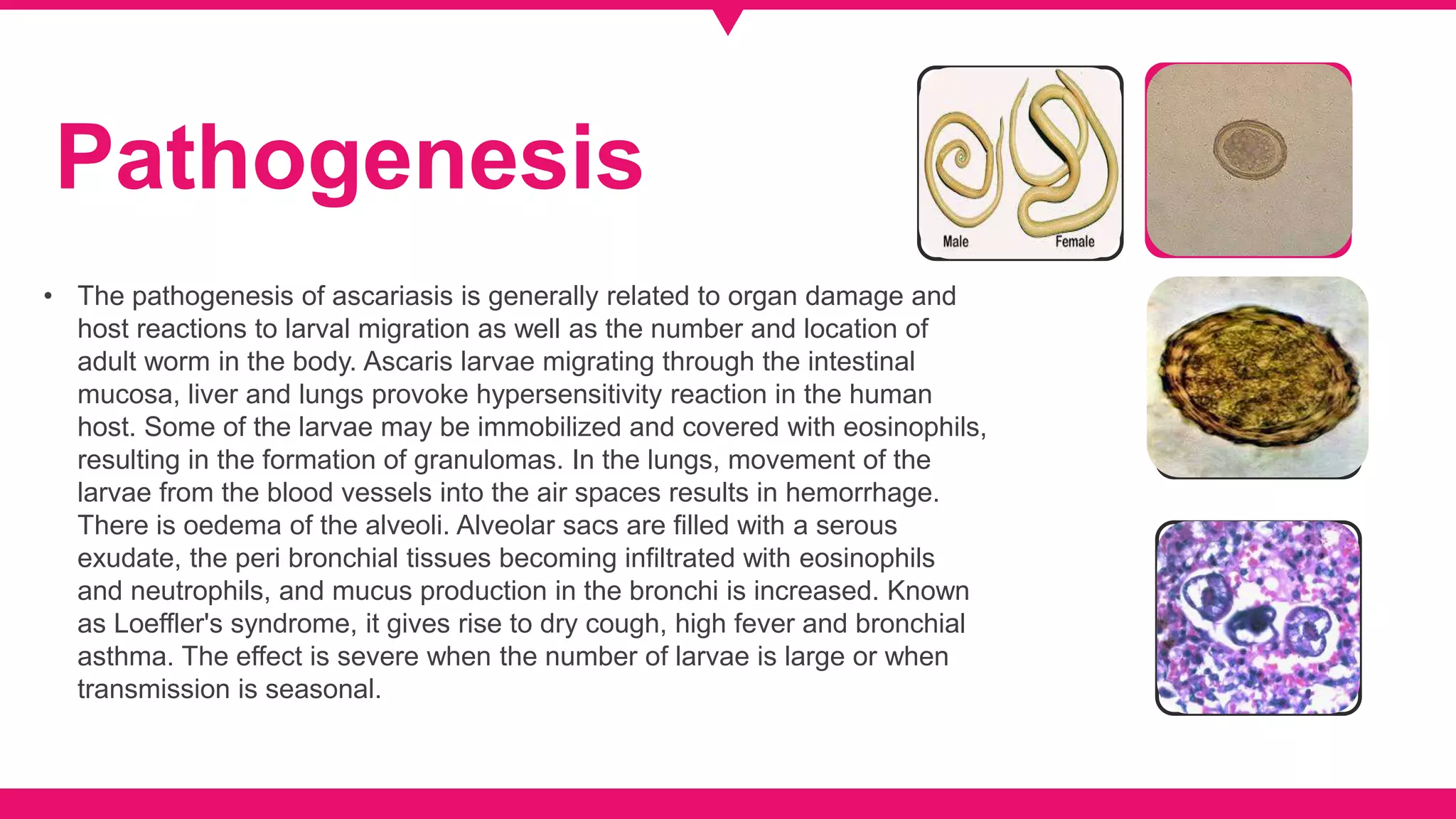 Ascariasis PPT | PPTX