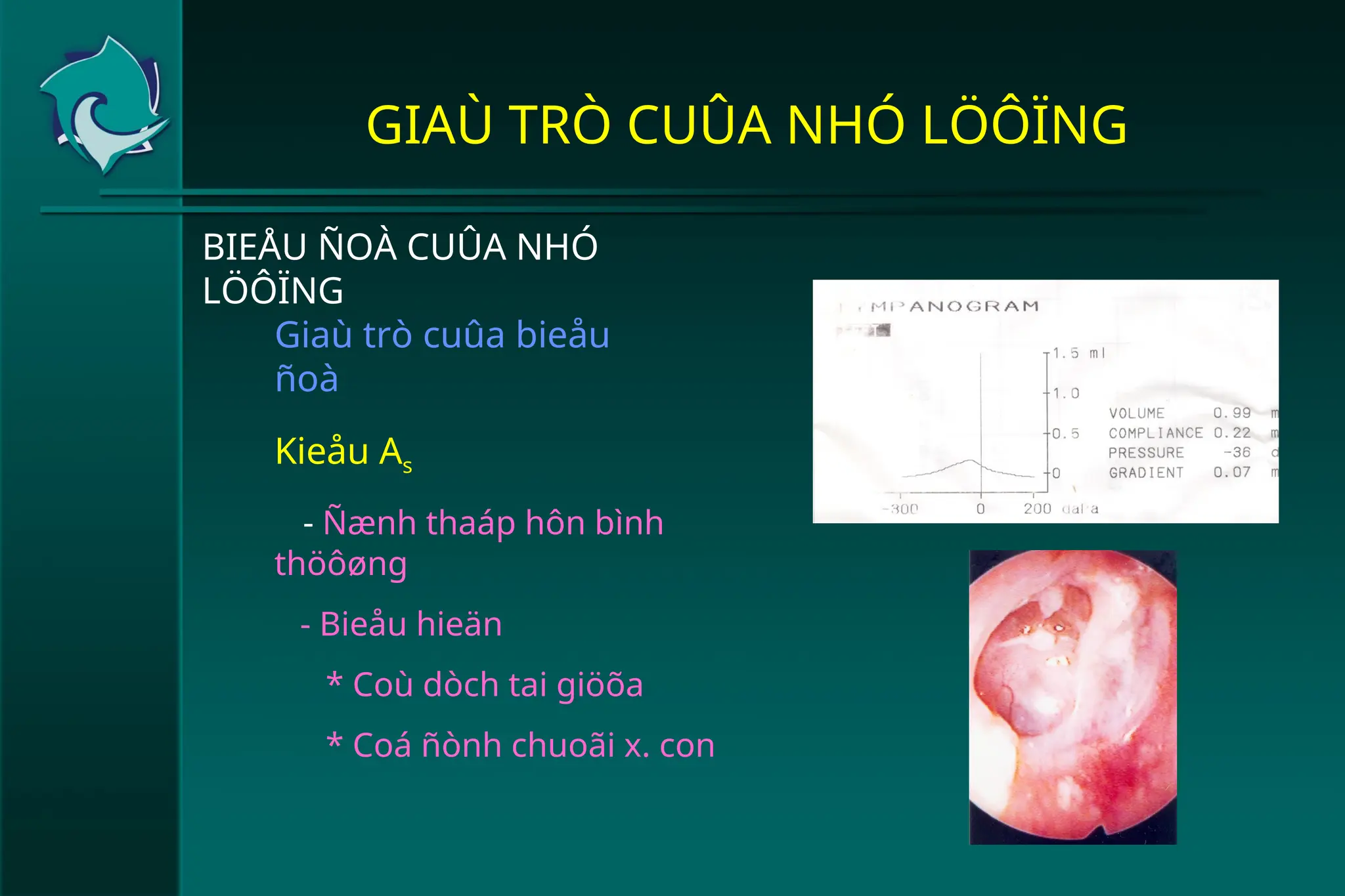 KHAO SAT NHI LUONG.ppt trong kham tai mui hong | PPT
