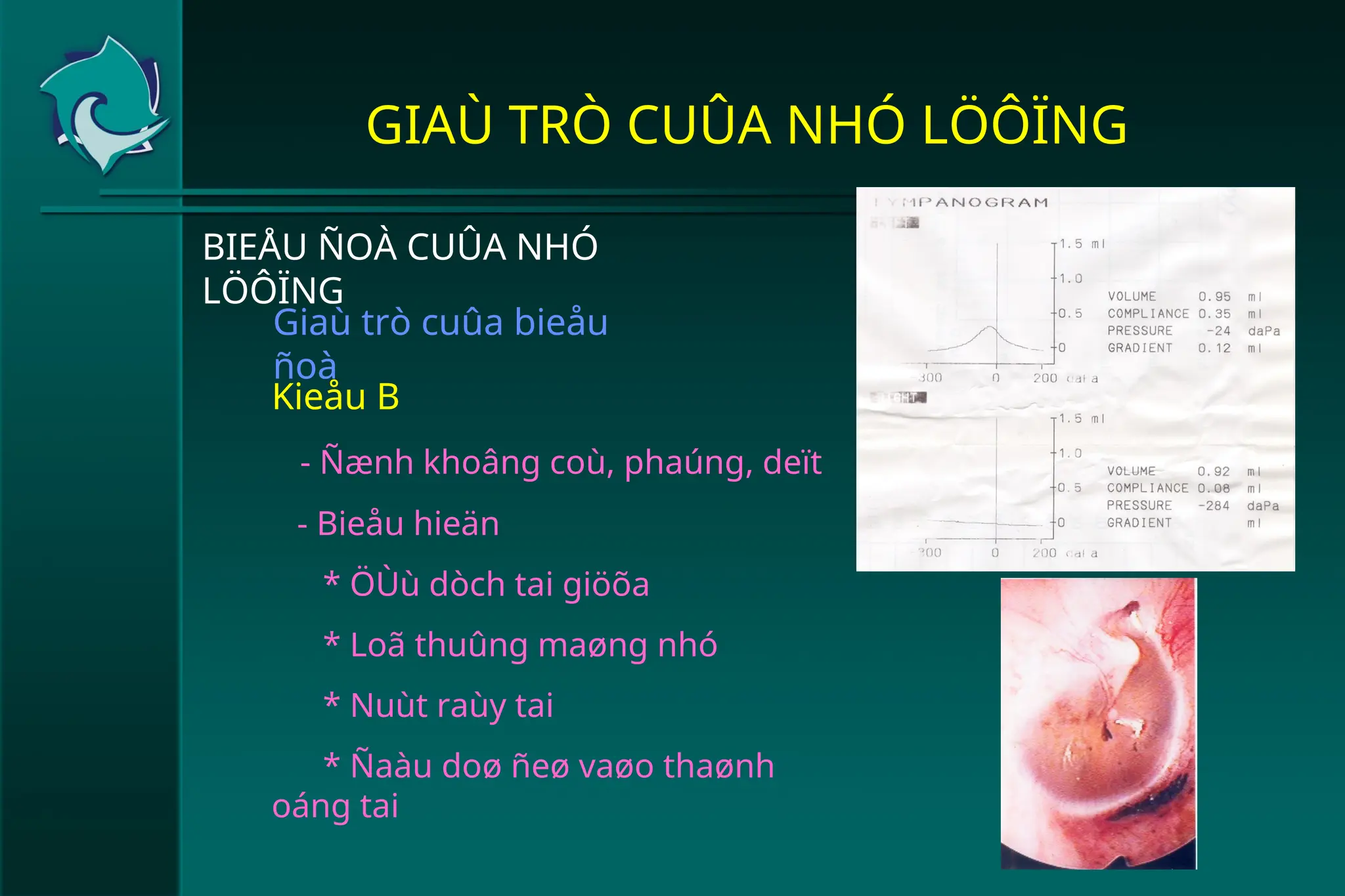 KHAO SAT NHI LUONG.ppt trong kham tai mui hong | PPT