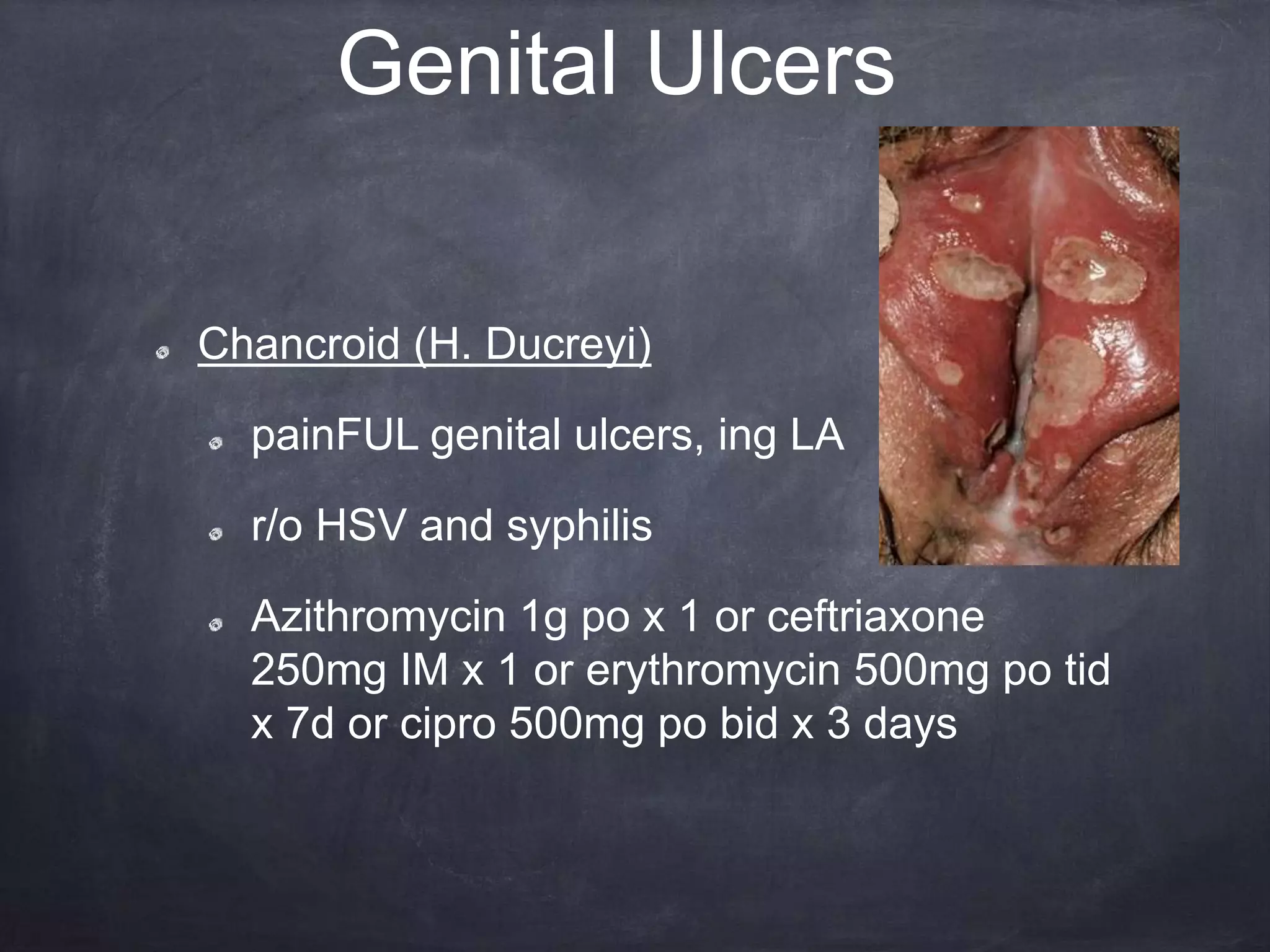 Khmh Obs Gyn Infections Pid Ulcers Stds Vaginitisppt