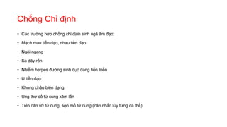 Khởi phát chuyển dạ.pptx