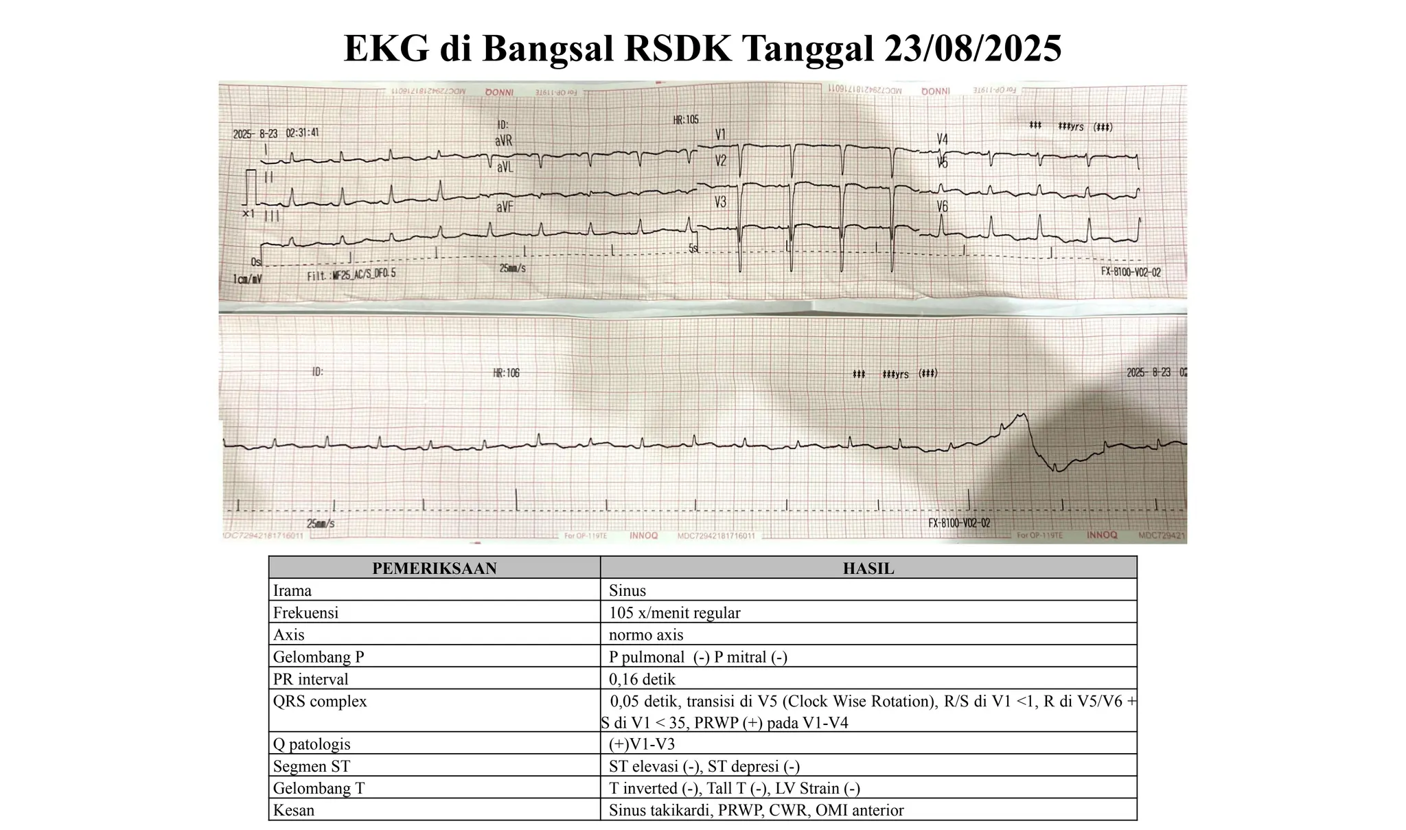 Khoiriyah - NSTEMI, Sindroma metabolik.pptx