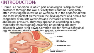 Presentation on hernia which you require | PPTX