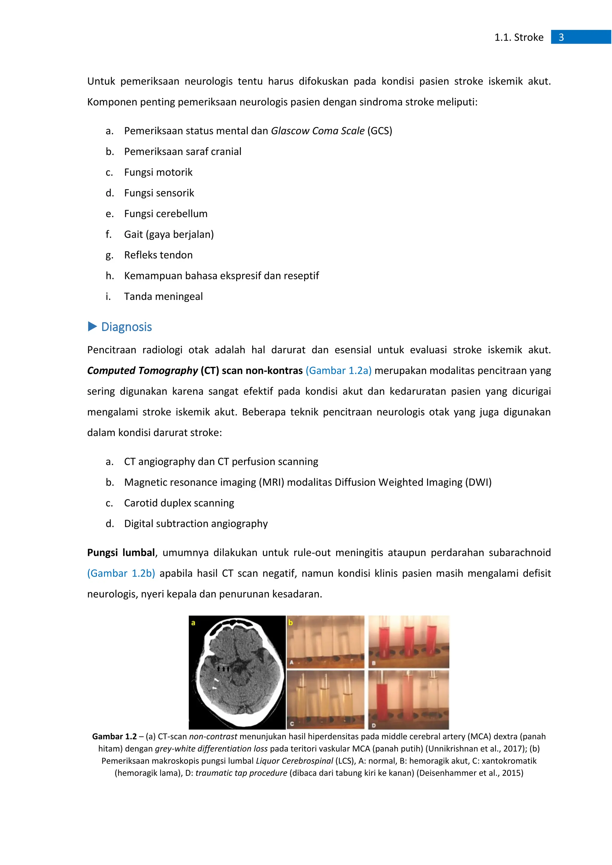 buku tentang terbaru stroke iskemik akut ebook.pdf