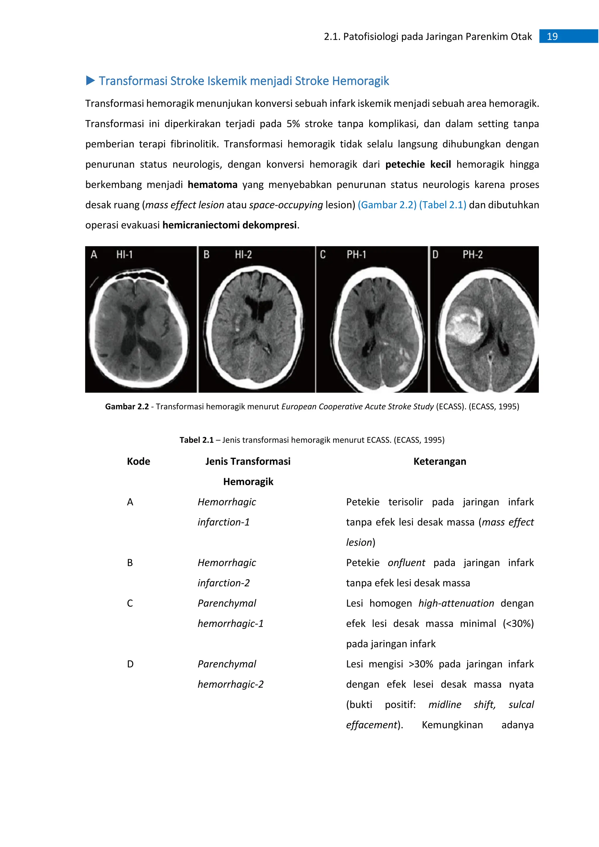 buku tentang terbaru stroke iskemik akut ebook.pdf
