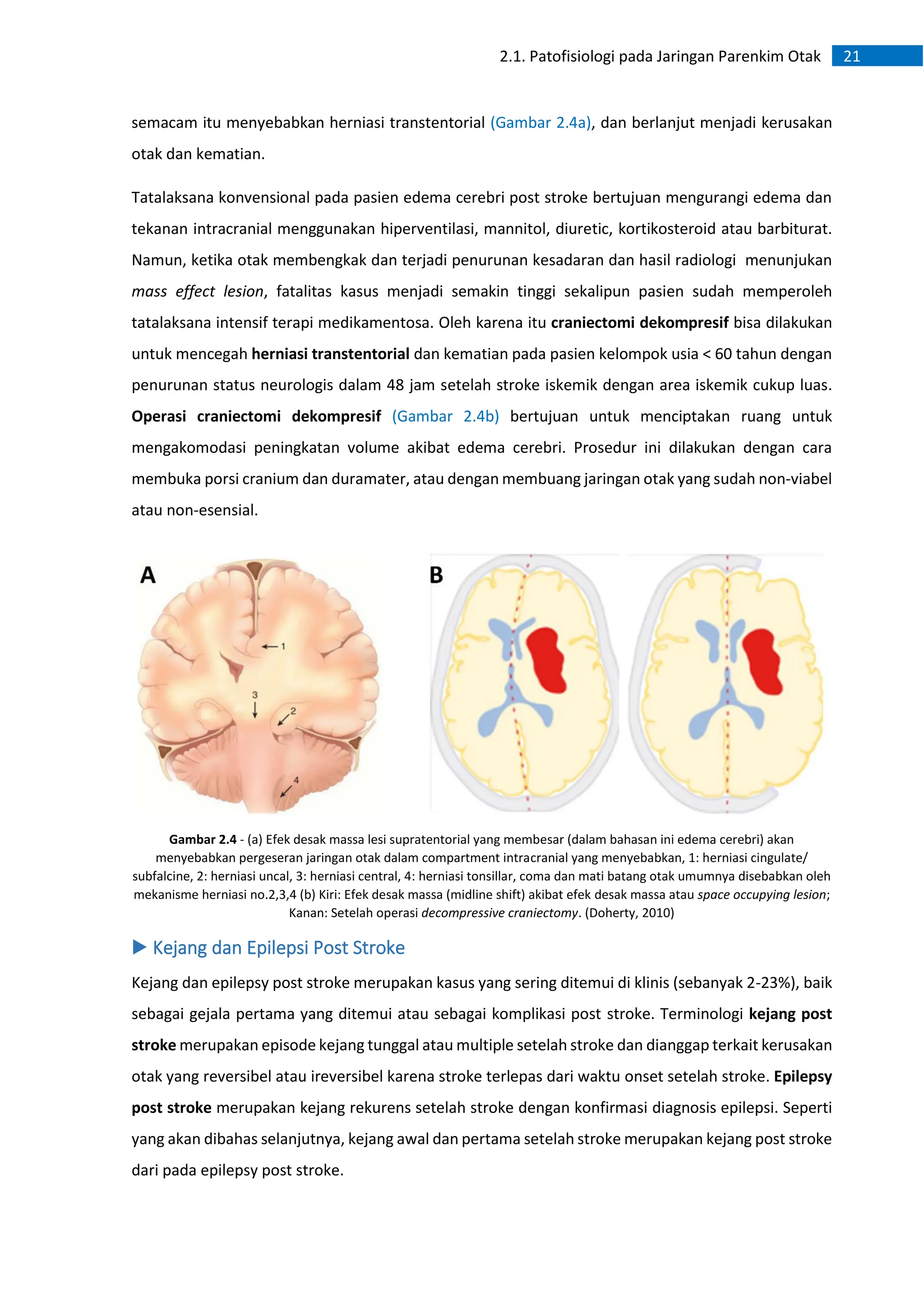 buku tentang terbaru stroke iskemik akut ebook.pdf