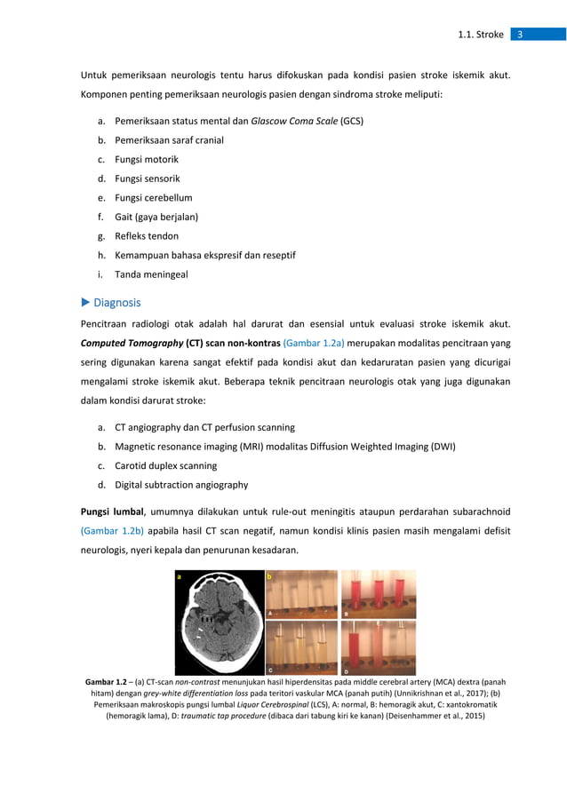 buku tentang terbaru stroke iskemik akut ebook.pdf