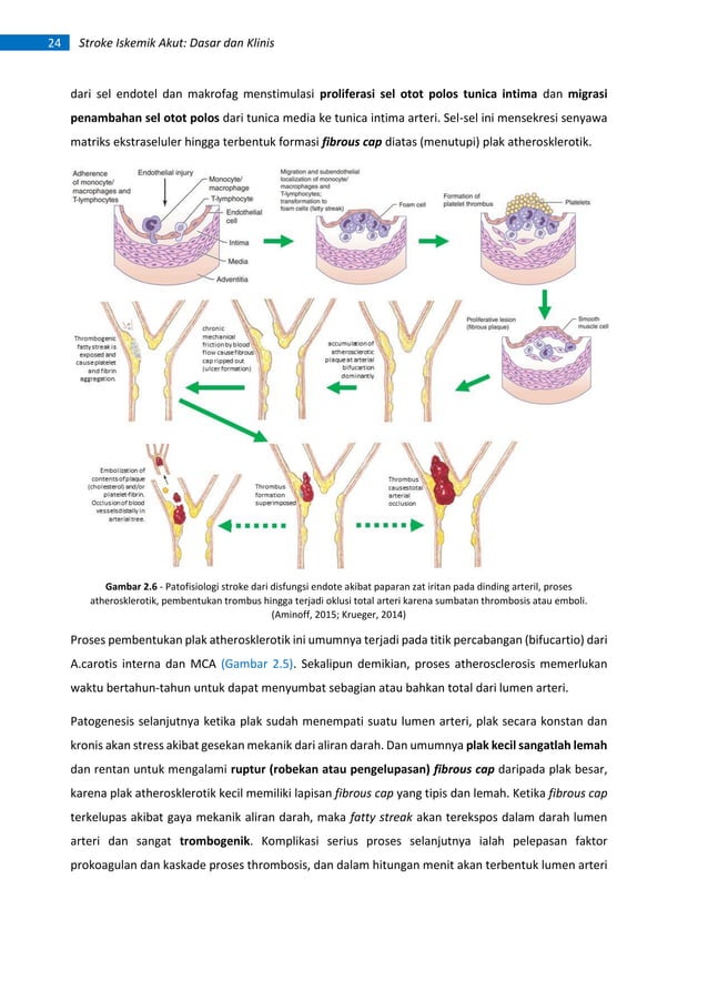buku tentang terbaru stroke iskemik akut ebook.pdf