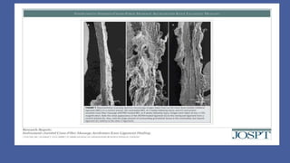 Instruments Assisted Soft Tissue Mobilization | PPTX