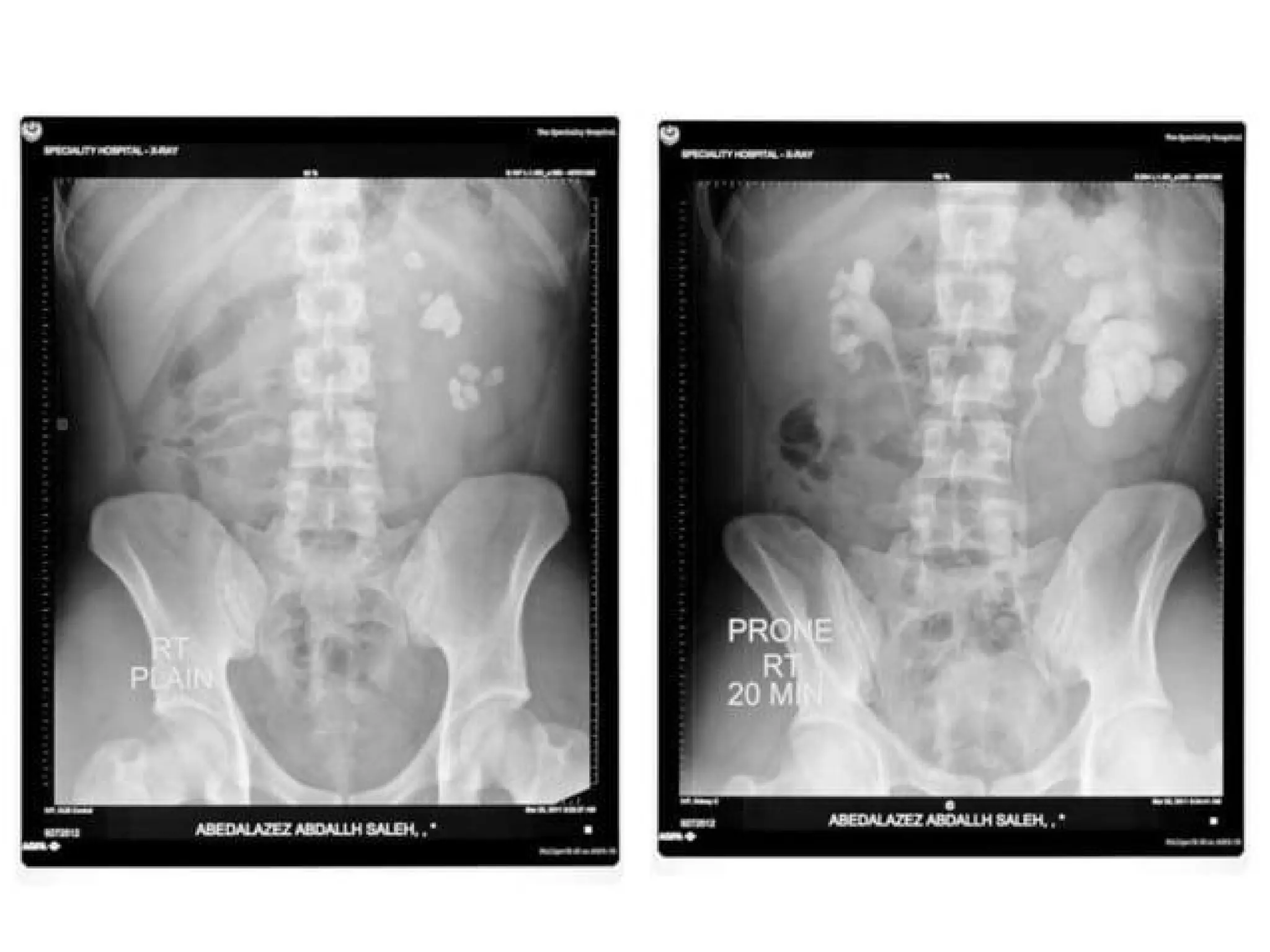 Imaging Anatomy of UT and some common Pathologies differences as a ...