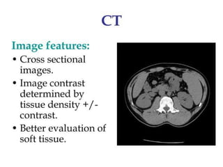 Imaging Anatomy of UT and some common Pathologies differences as a ...