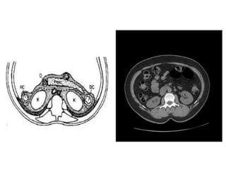 Imaging Anatomy of UT and some common Pathologies differences as a ...