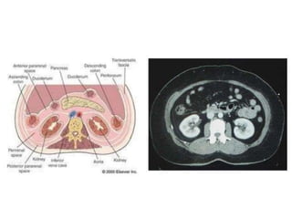 Imaging Anatomy of UT and some common Pathologies differences as a ...