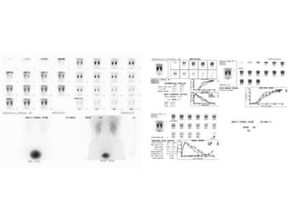 Imaging Anatomy of UT and some common Pathologies differences as a ...