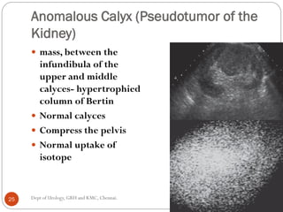 ANOMALY OF COLLECTING DUCT | PPT