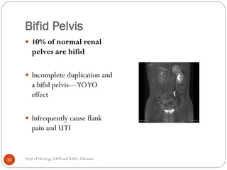 ANOMALY OF COLLECTING DUCT | PPT