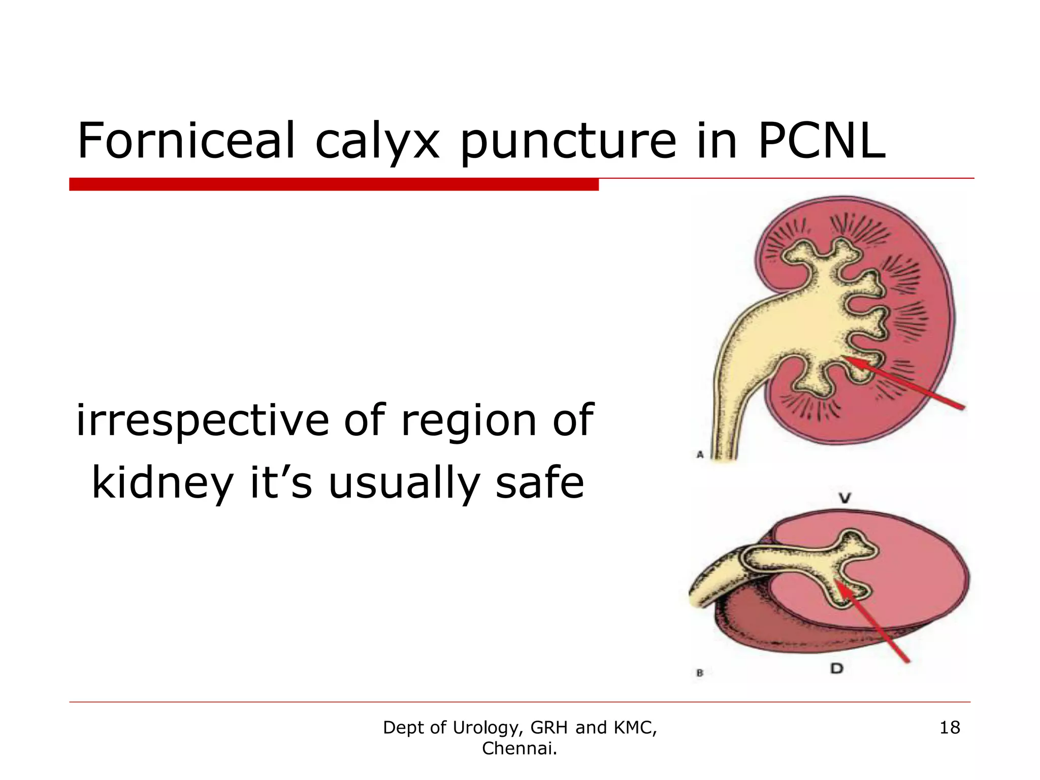 RENOVASCULAR ANATOMY AND ANGIOGRAPHY | PDF