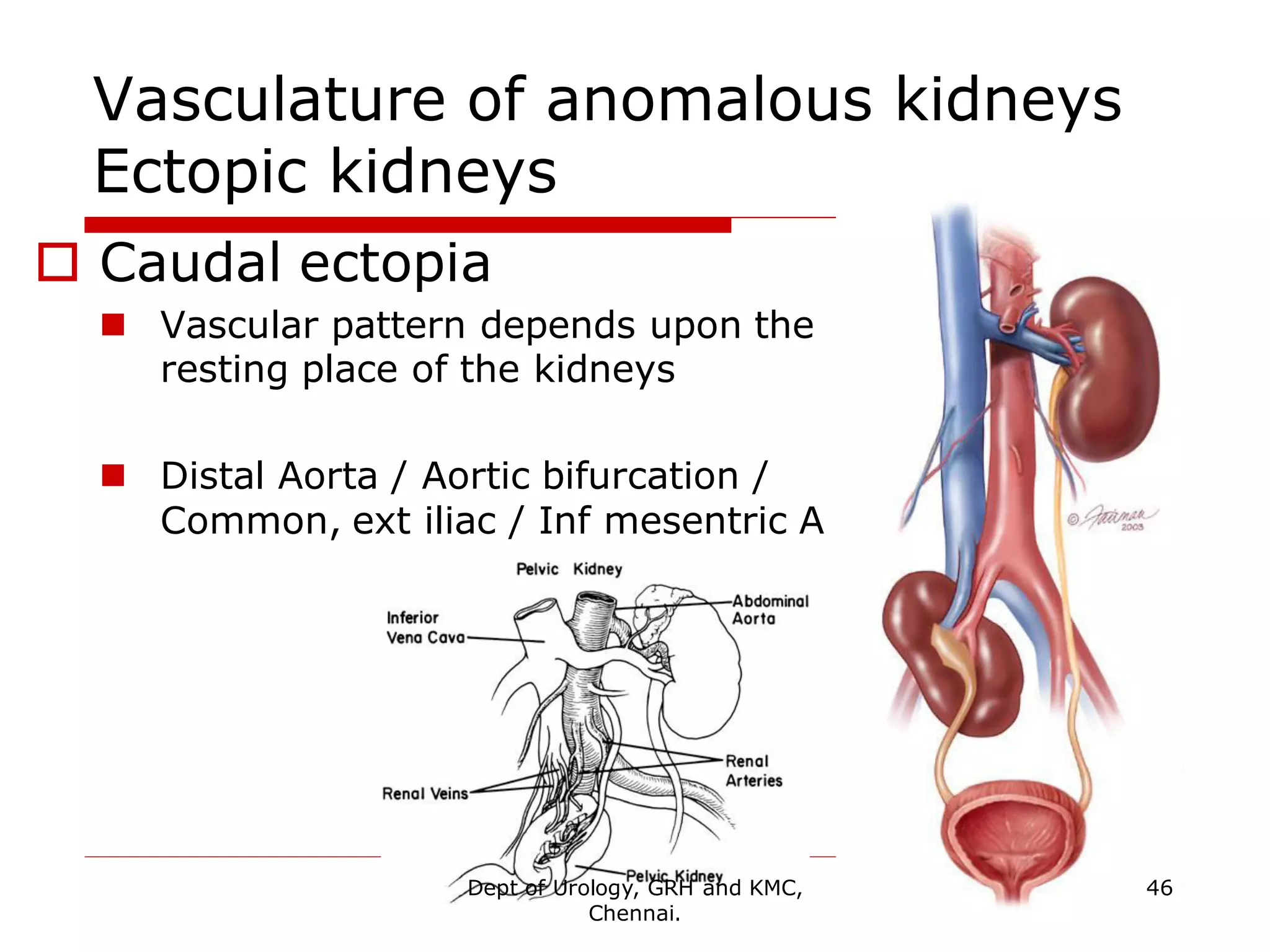 RENOVASCULAR ANATOMY AND ANGIOGRAPHY | PDF