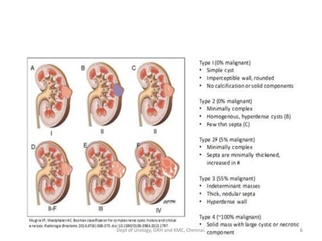 RENAL CYSTIC DISEASE | PDF | Genetics | Science
