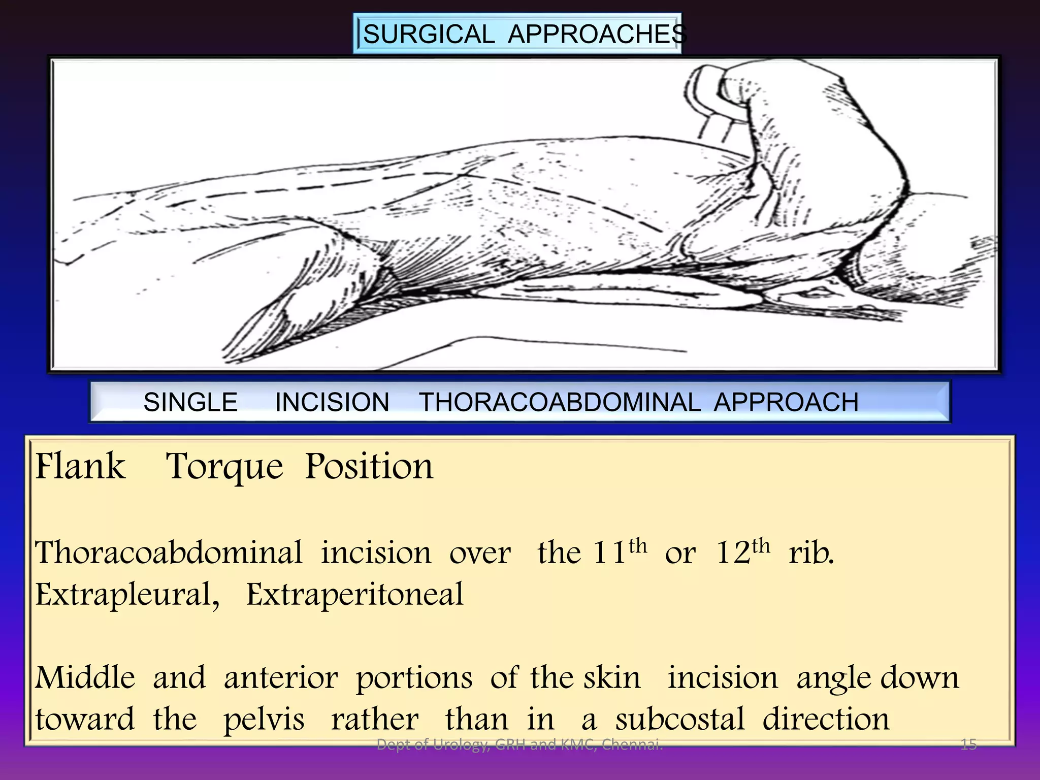 Upper urinary tract - Urothelial cell carcinoma | PDF