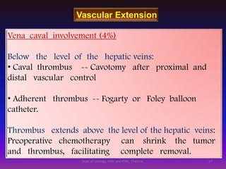 Upper urinary tract - Urothelial cell carcinoma | PDF