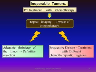 Upper urinary tract - Urothelial cell carcinoma | PDF | Cancer ...