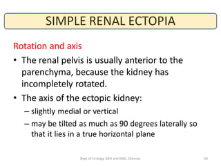 Congenital anomalies of kidney. | PDF