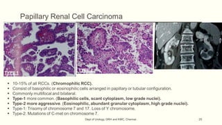 RENAL TUMOURS | PDF