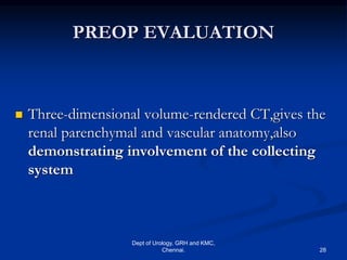 SMALL RENAL MASS | PDF