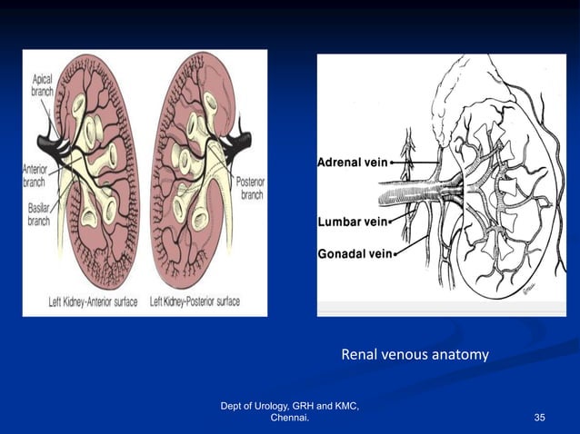 SMALL RENAL MASS | PPT
