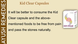 Kidney Stone Diet, List of Foods to Eat and Avoid During Kidney Stones ...