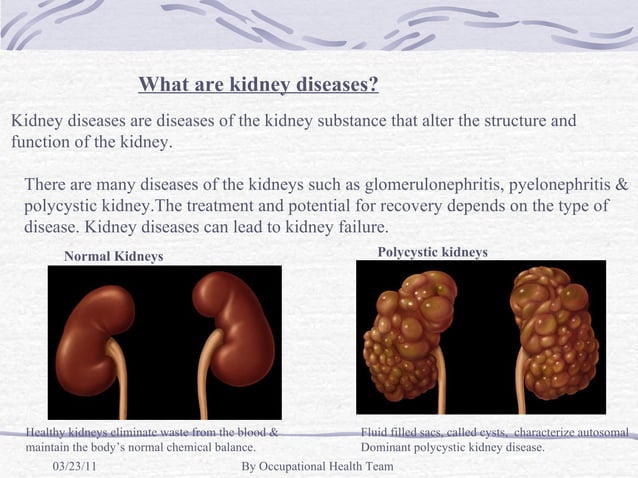 Know Your Kidneys | PPT | Free Download