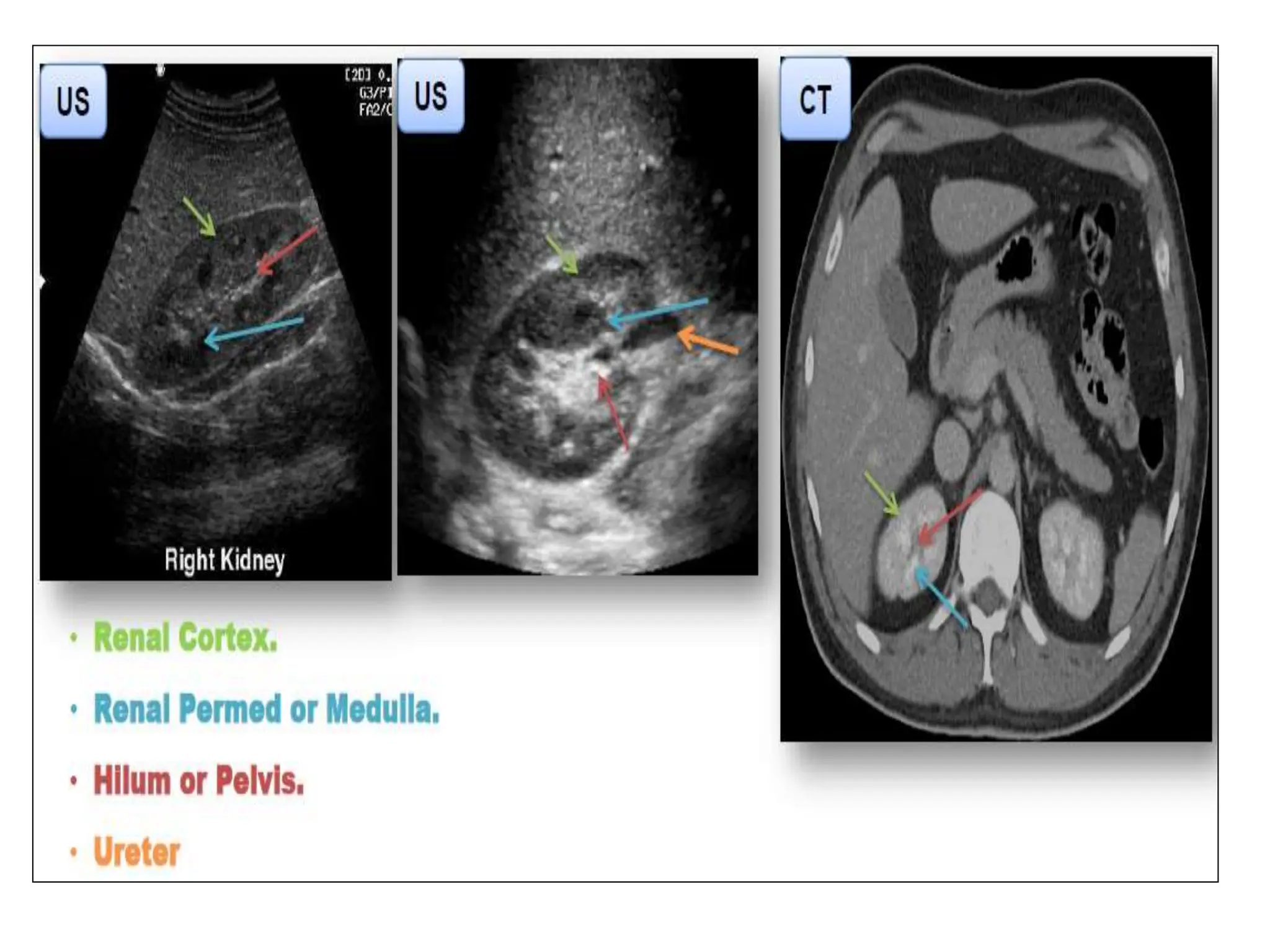 kidney information. Management morphology | PPT