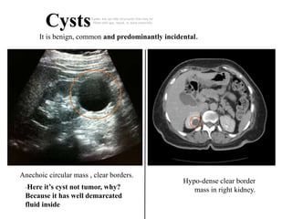 kidney information. Management morphology | PPTX
