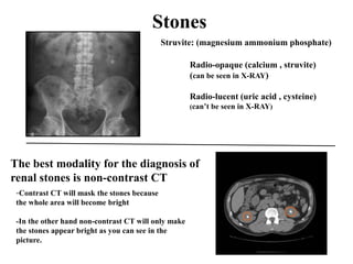 kidney information. Management morphology | PPT