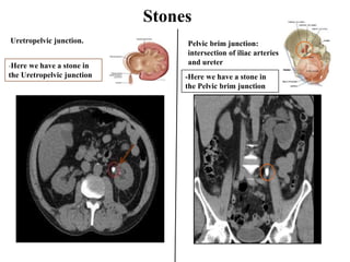 kidney information. Management morphology | PPTX