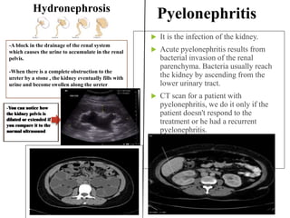 kidney information. Management morphology | PPT