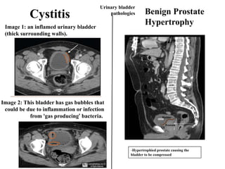 kidney information. Management morphology | PPT