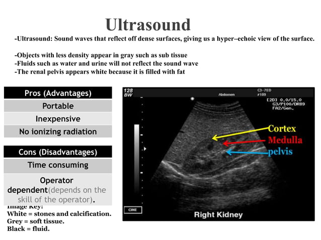 kidney information. Management morphology | PPT