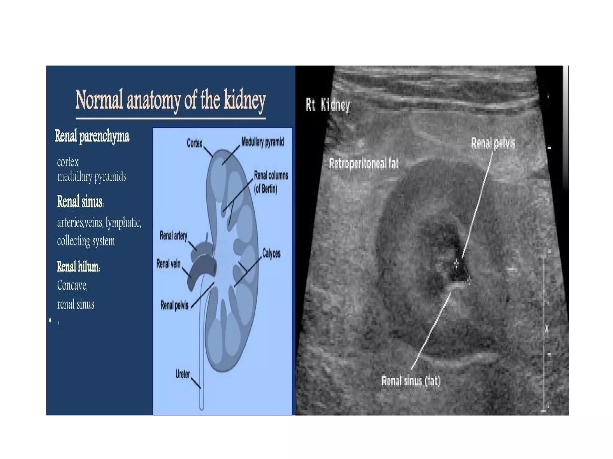 Kidney ultrasound | PPT | Medical Health