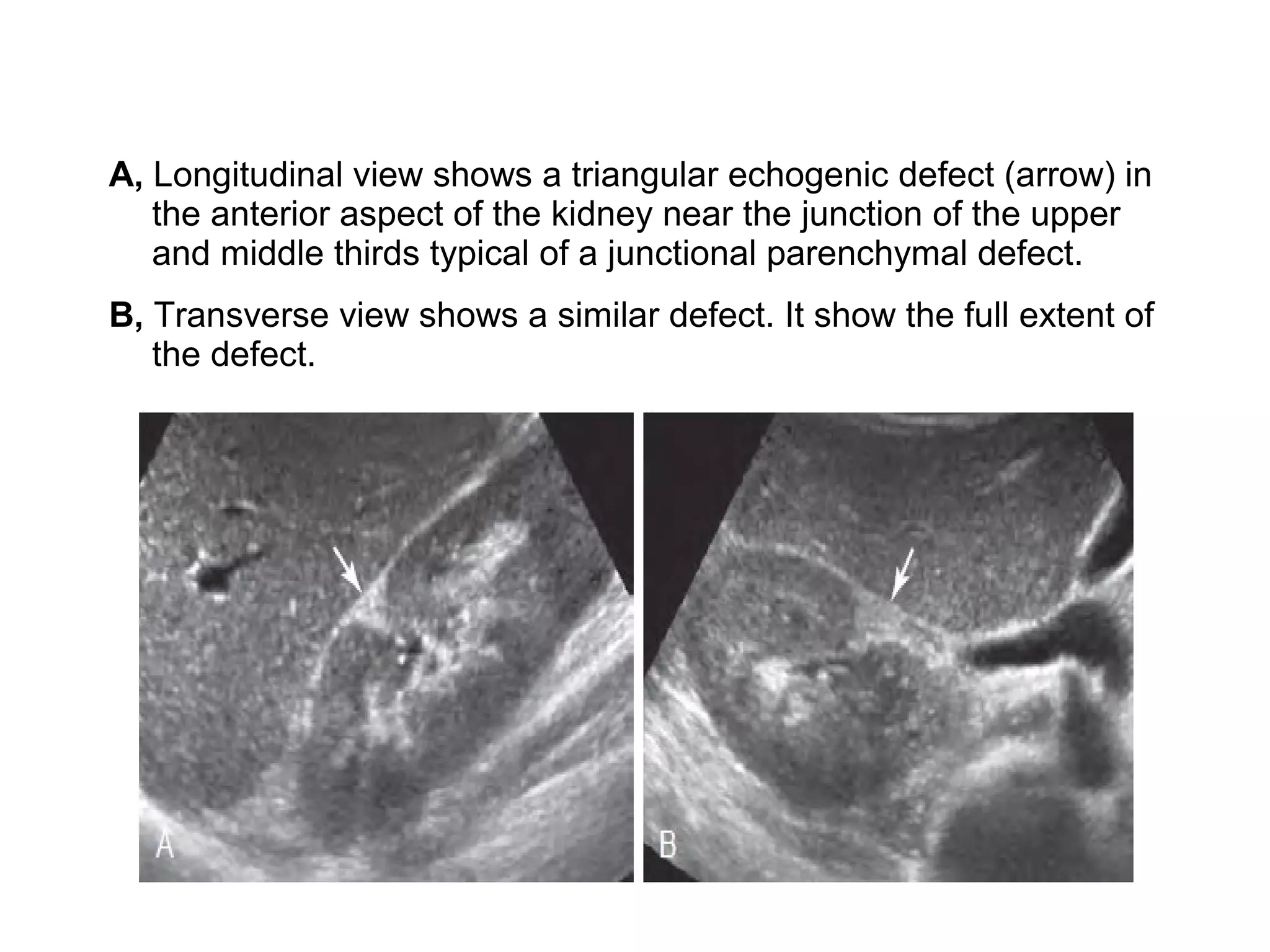 Kidney ultrasound | PPT