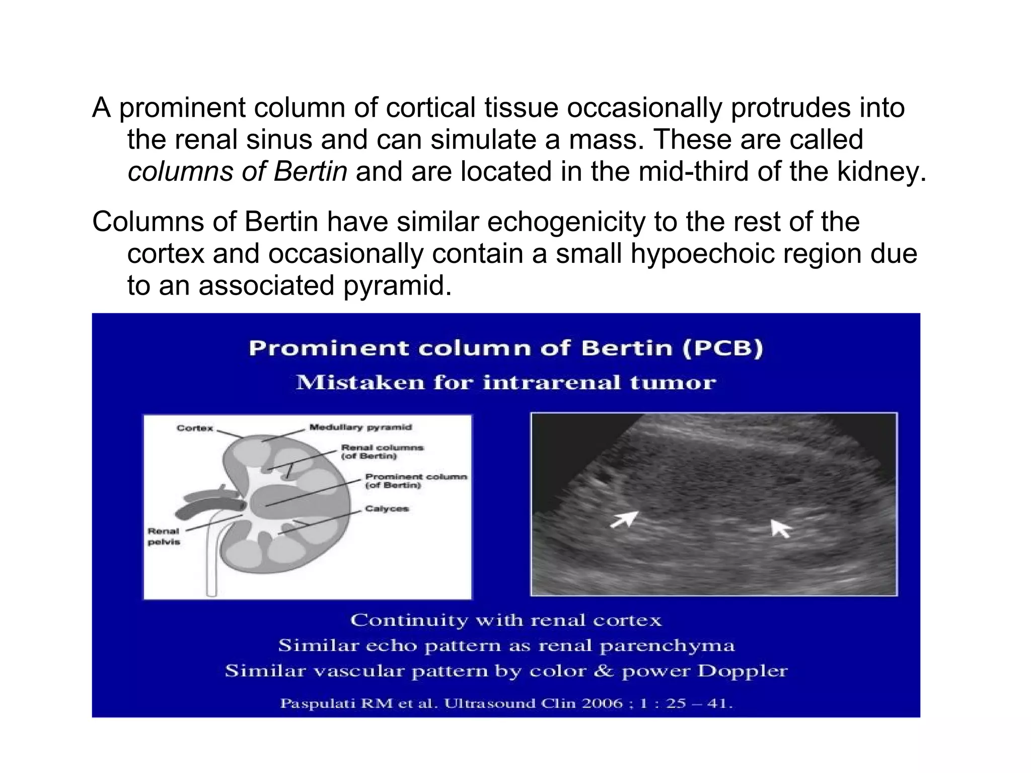 Kidney ultrasound | PPT