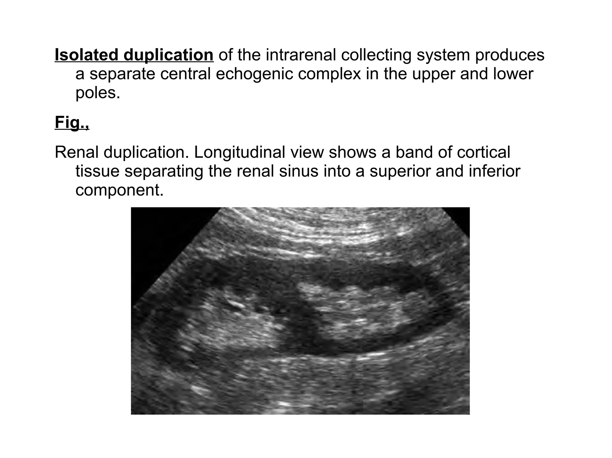 Kidney ultrasound | PPT