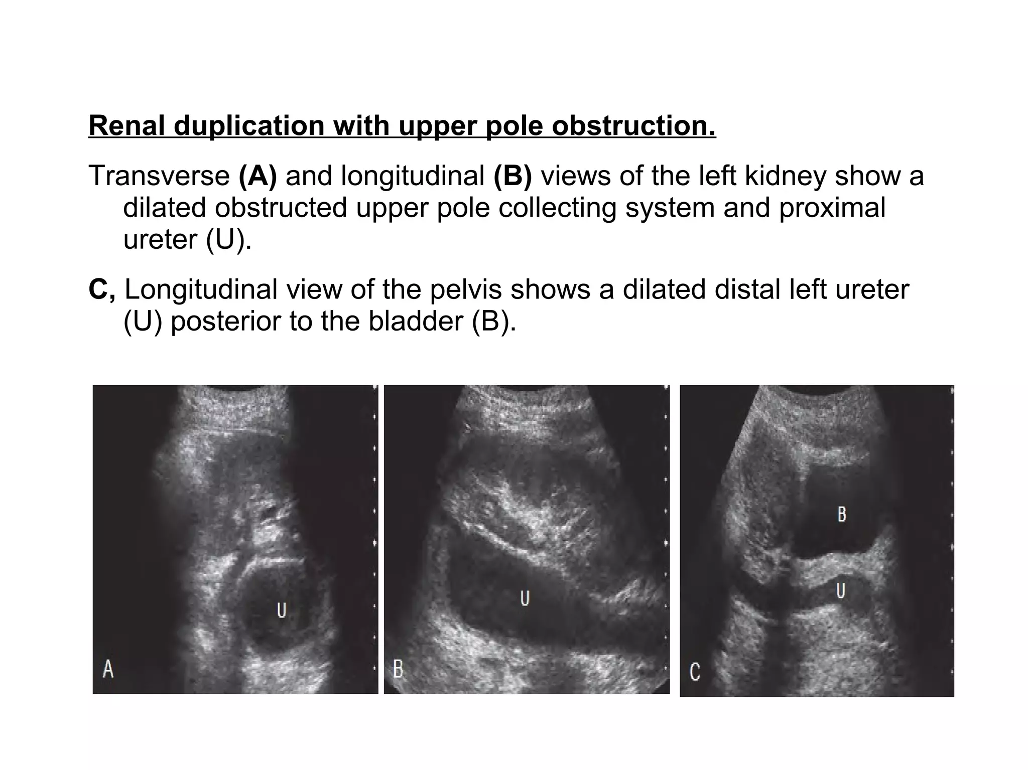 Kidney ultrasound | PPT