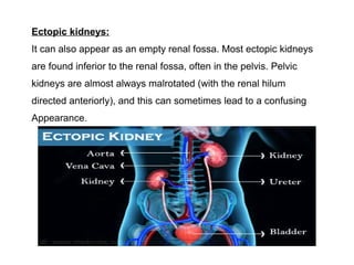 Kidney ultrasound | PPT