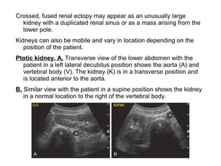 Kidney ultrasound | PPT